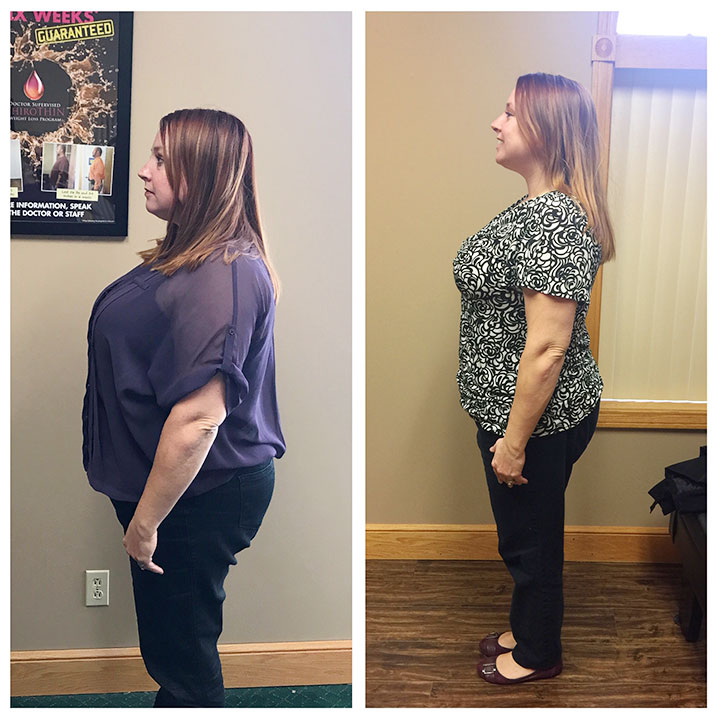 Renaissance Wellness | ChiroThin in East Aurora